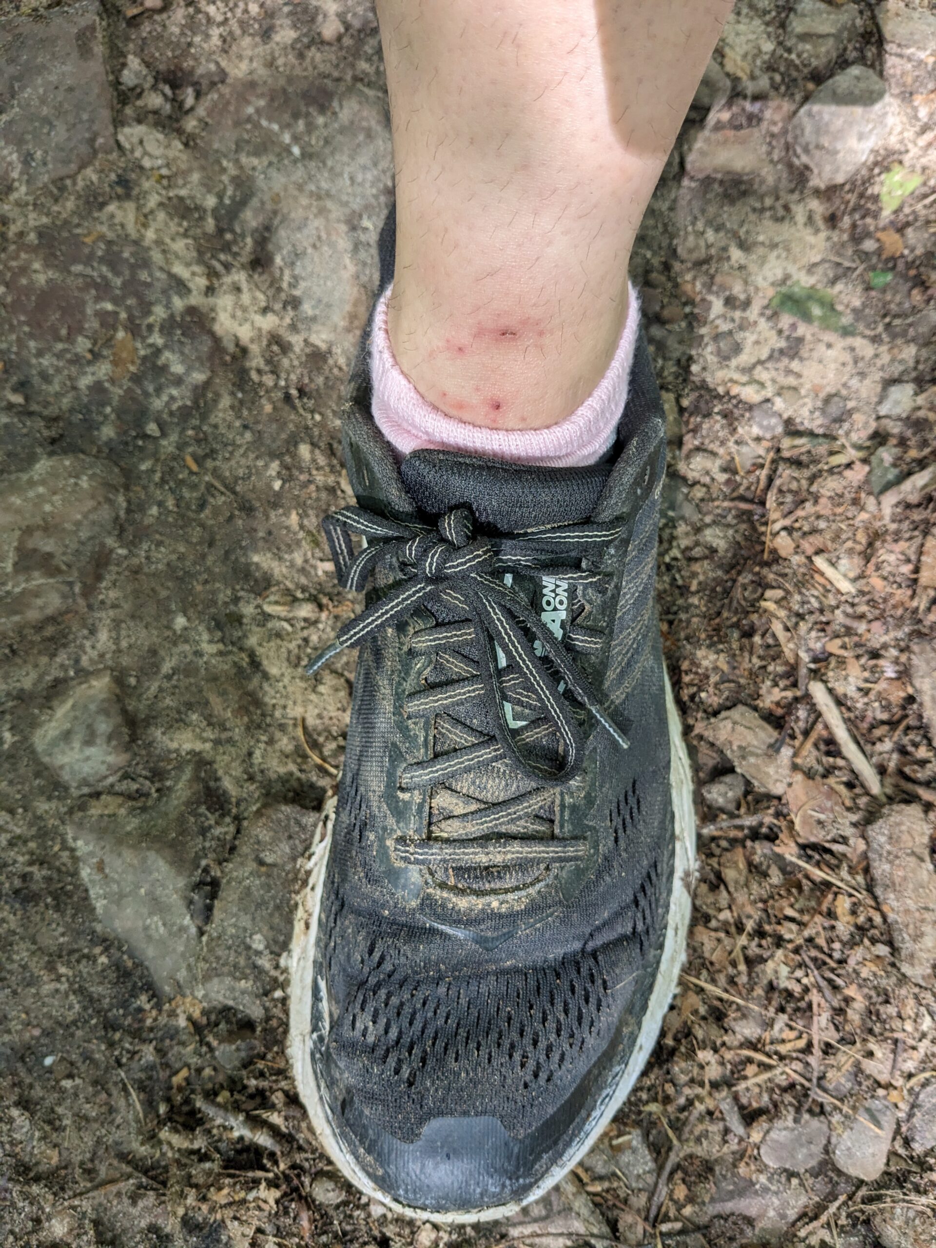 Skunk Attack on the Appalachian Trail (May 27) - The Trek